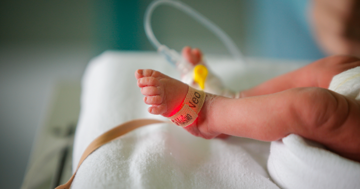 Extremely premature birth guideline review Supporting Queensland ...